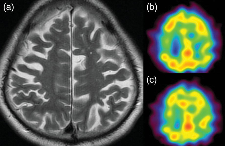 Diseases of the Central Nervous System | Radiology Key