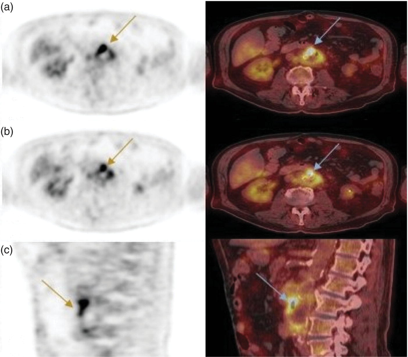 Vascular System | Radiology Key