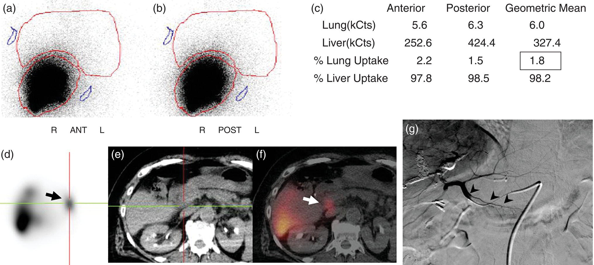 Hepatobiliary Imaging | Radiology Key