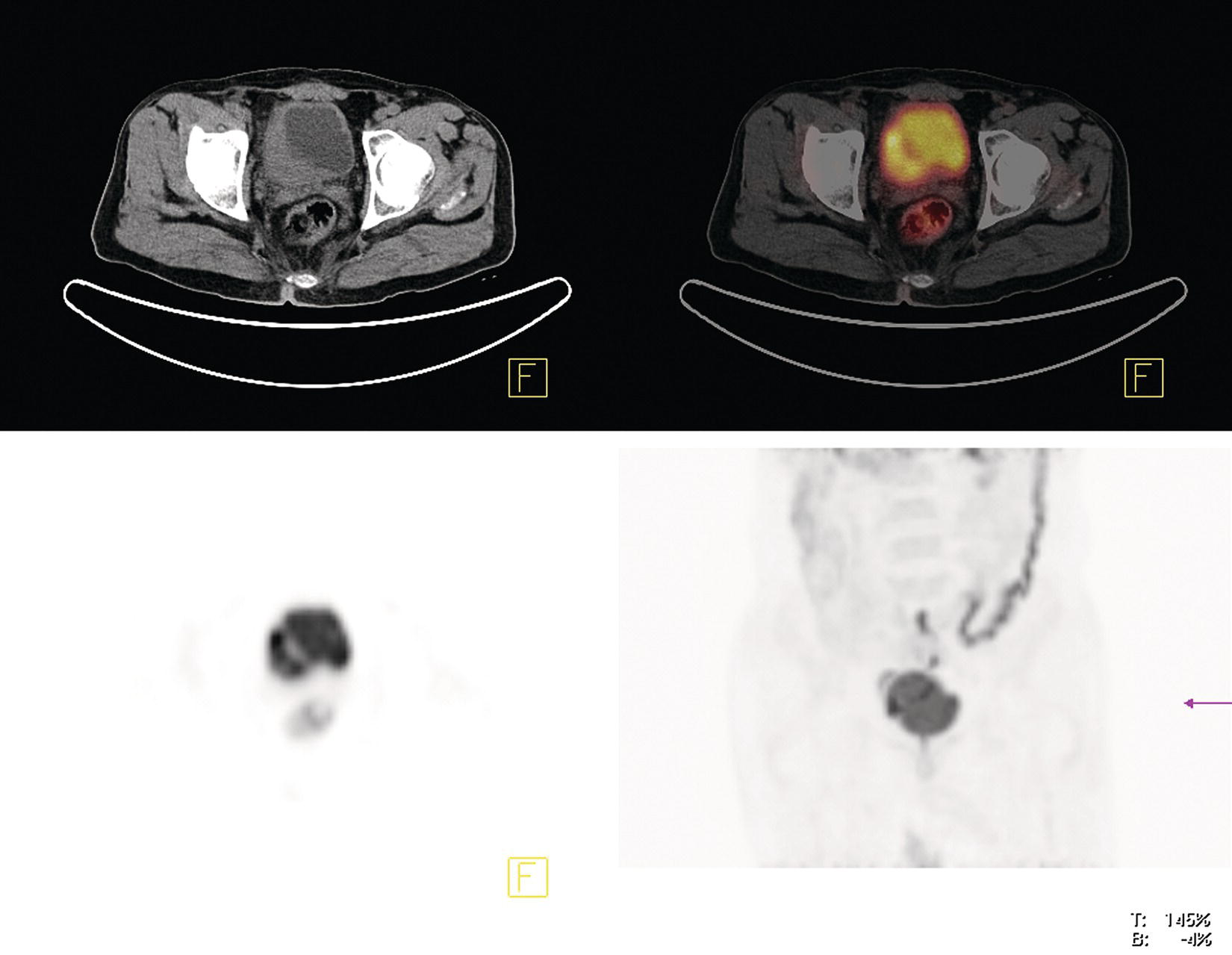 Nephro‐urinary Tract Pathologies: A Correlative Imaging Approach ...