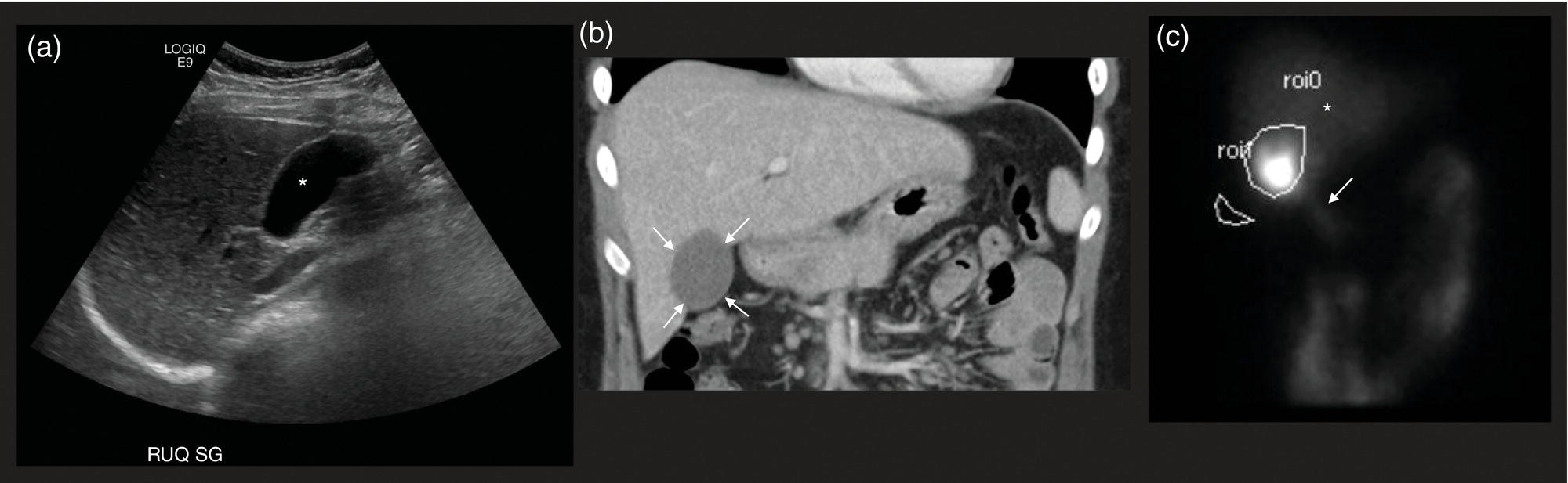 Imaging of Pediatric Diseases | Radiology Key