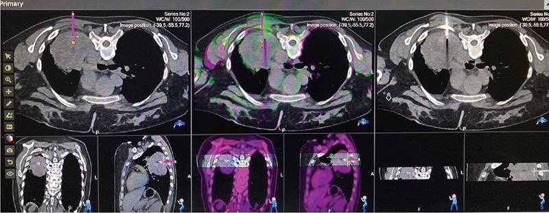 Interventional radiology – basic principles | Radiology Key
