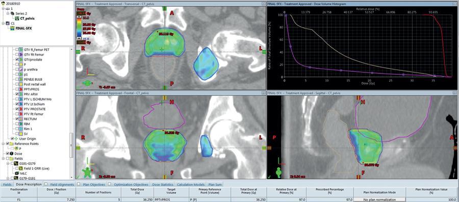 Evolving role of imaging sciences in radiotherapy | Radiology Key