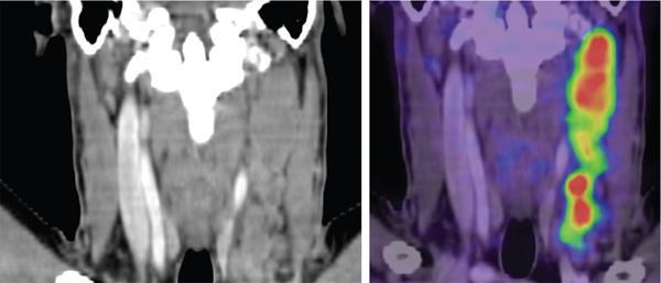 Radiological techniques, protocols and basics of interpretation in head ...