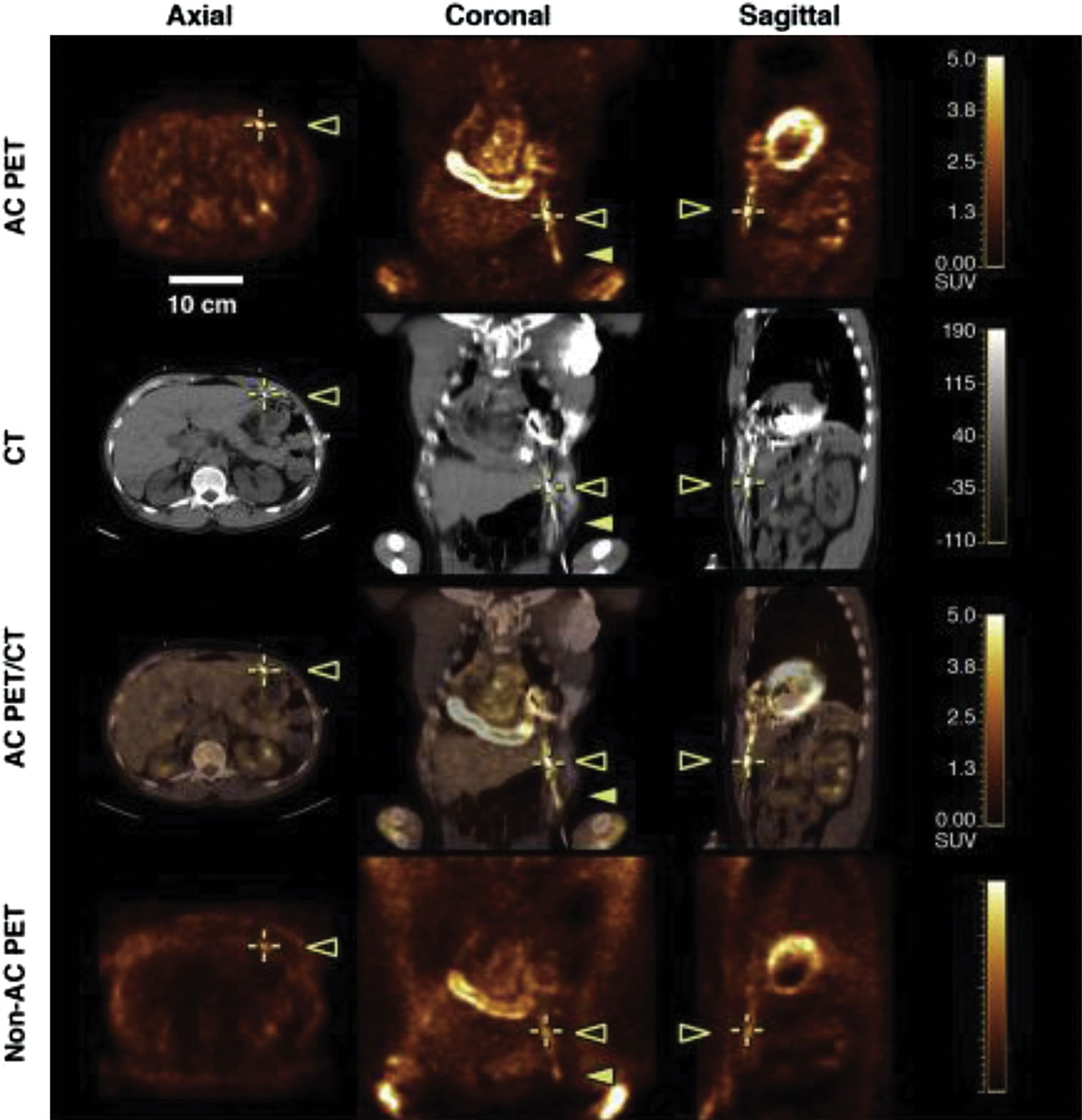 Mechanical Support Devices | Radiology Key
