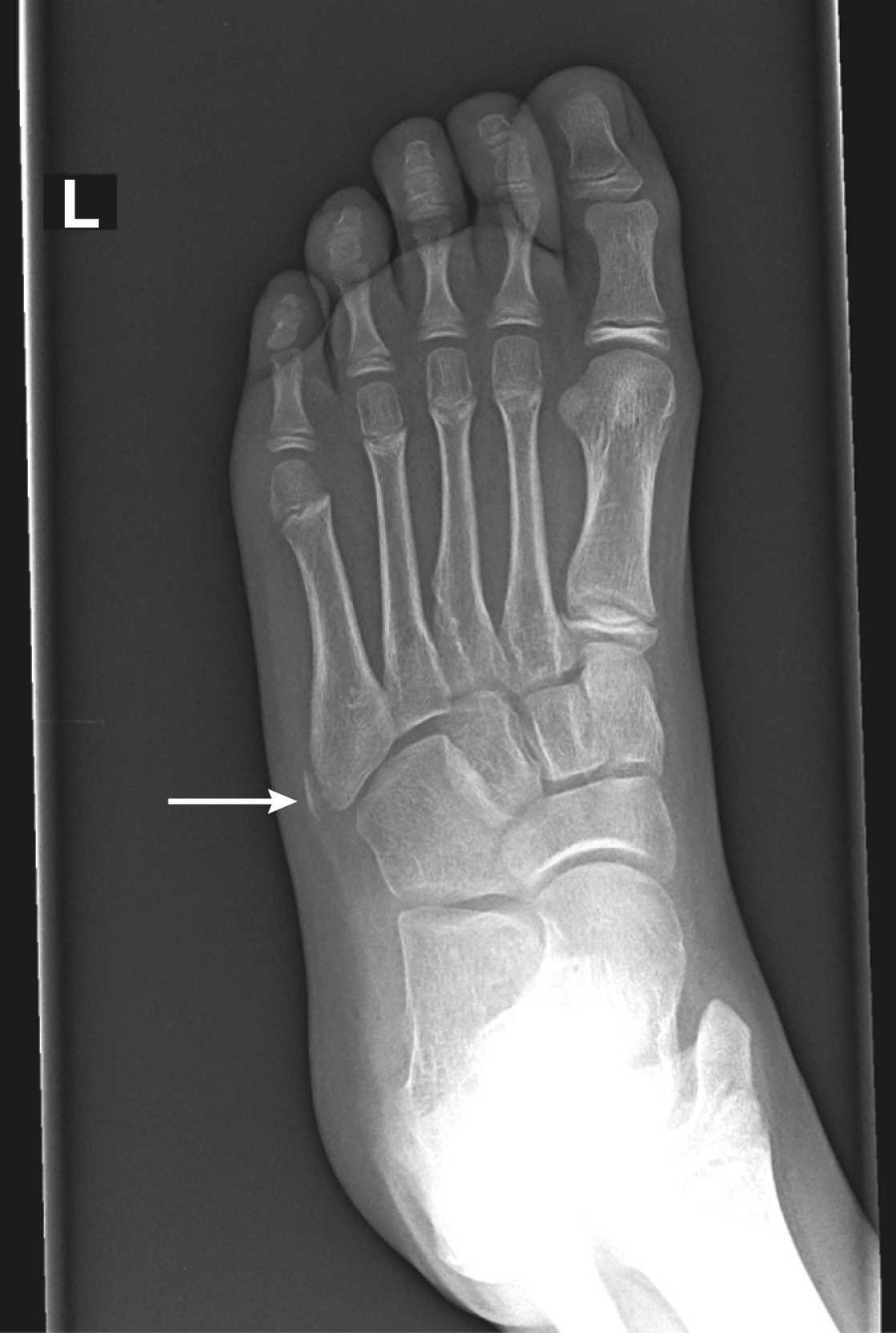 MSK Trauma | Radiology Key