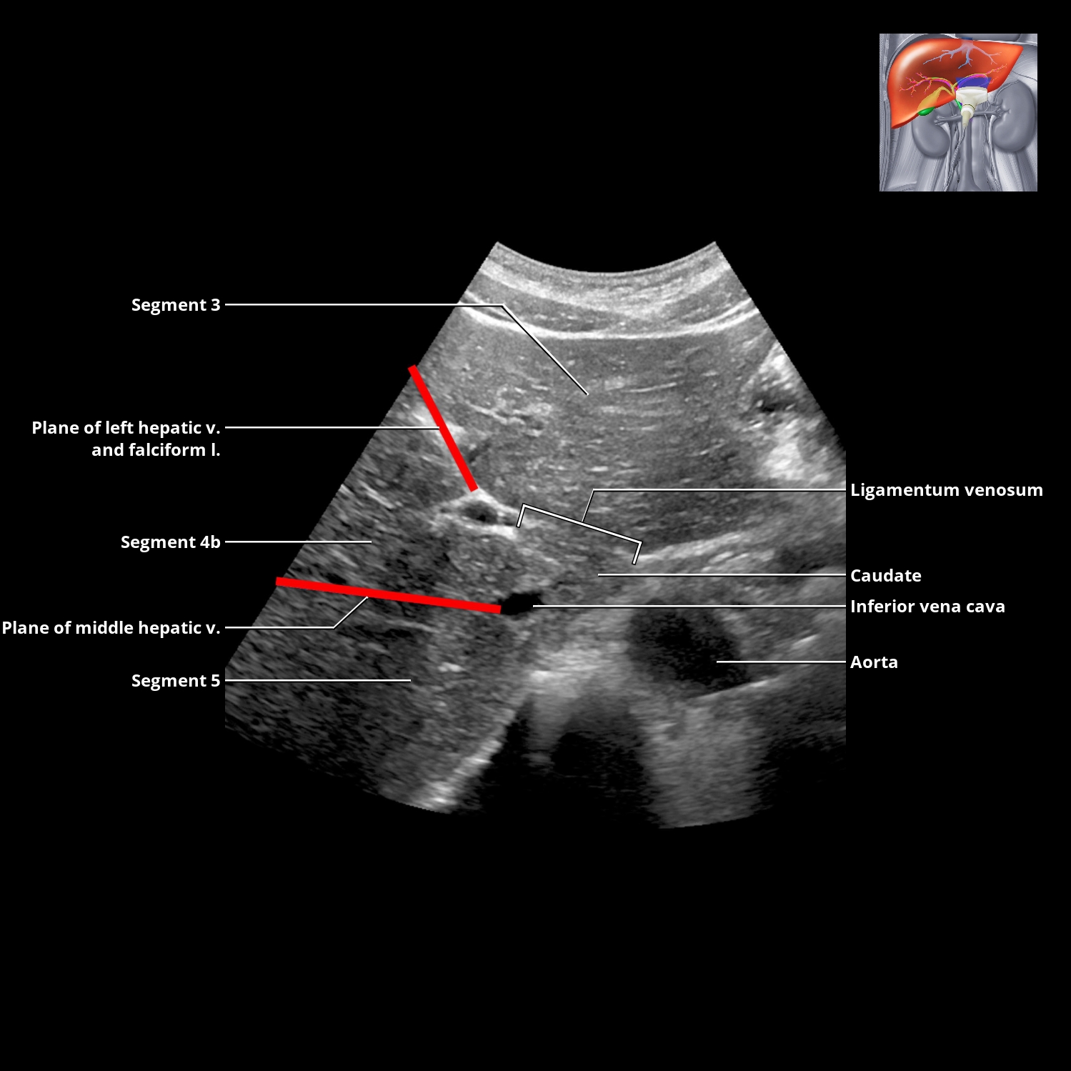 Liver | Radiology Key