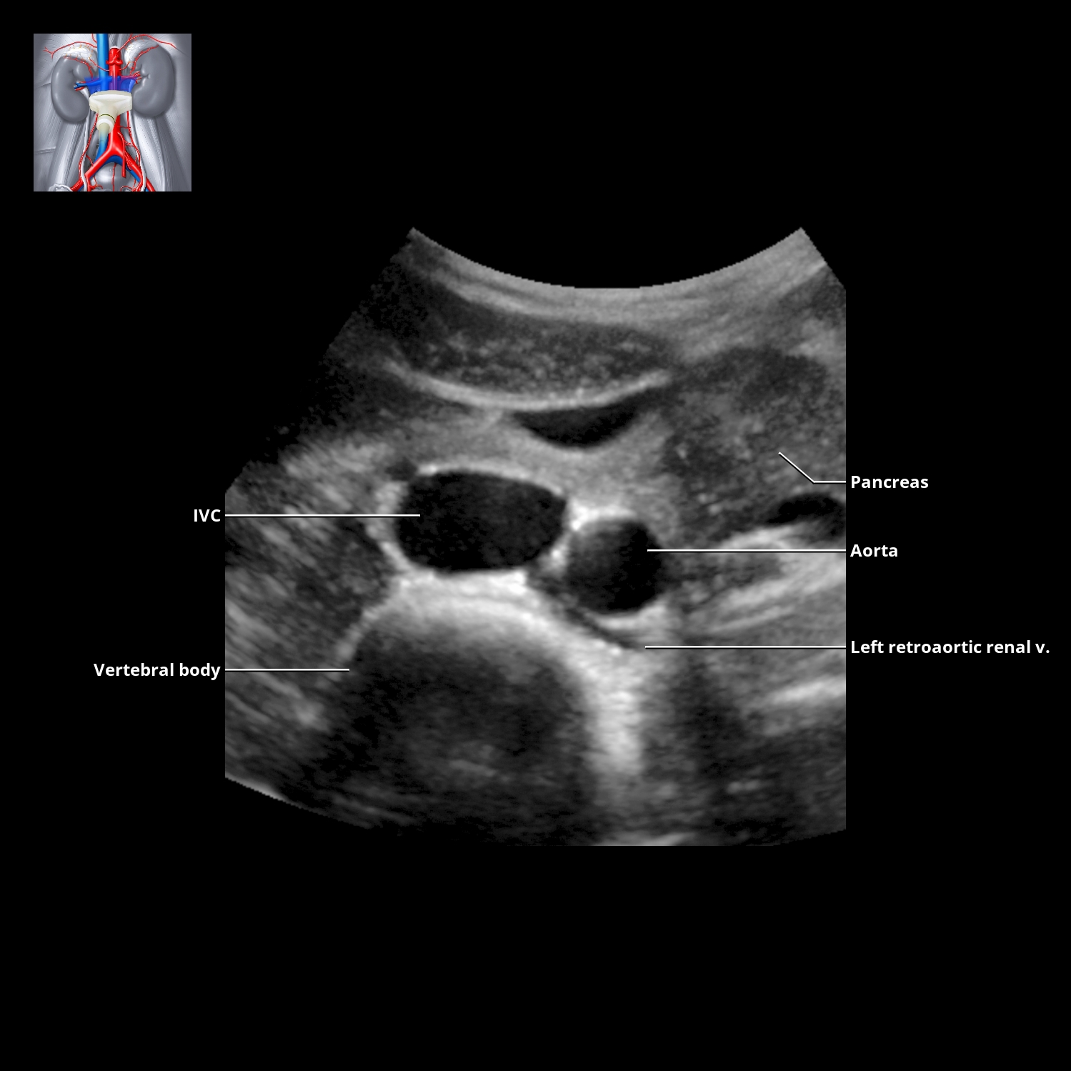 Kidneys | Radiology Key