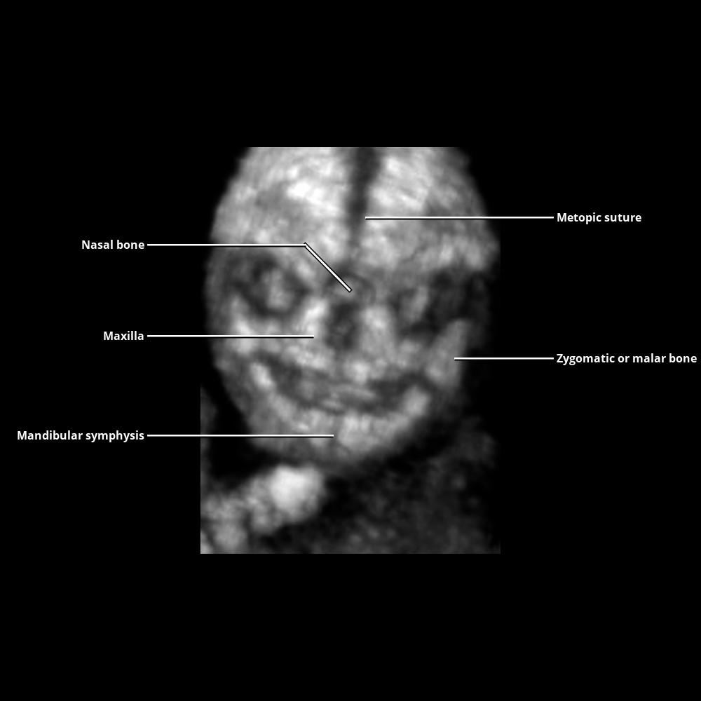 Face and Neck | Radiology Key