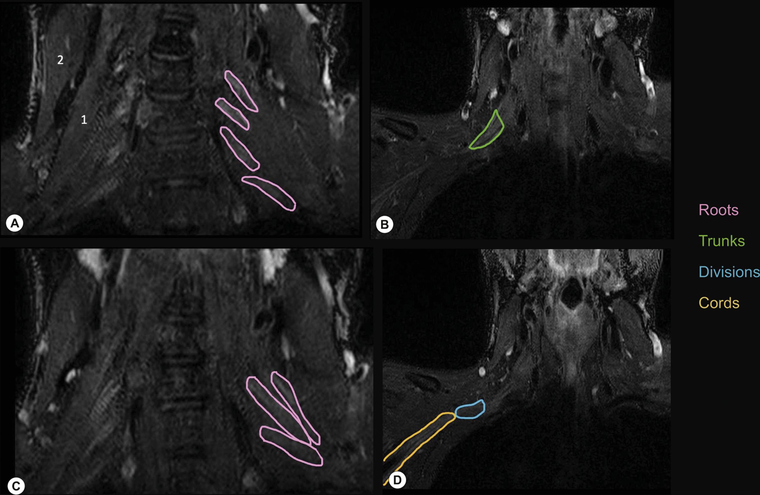 Head and Neck | Radiology Key