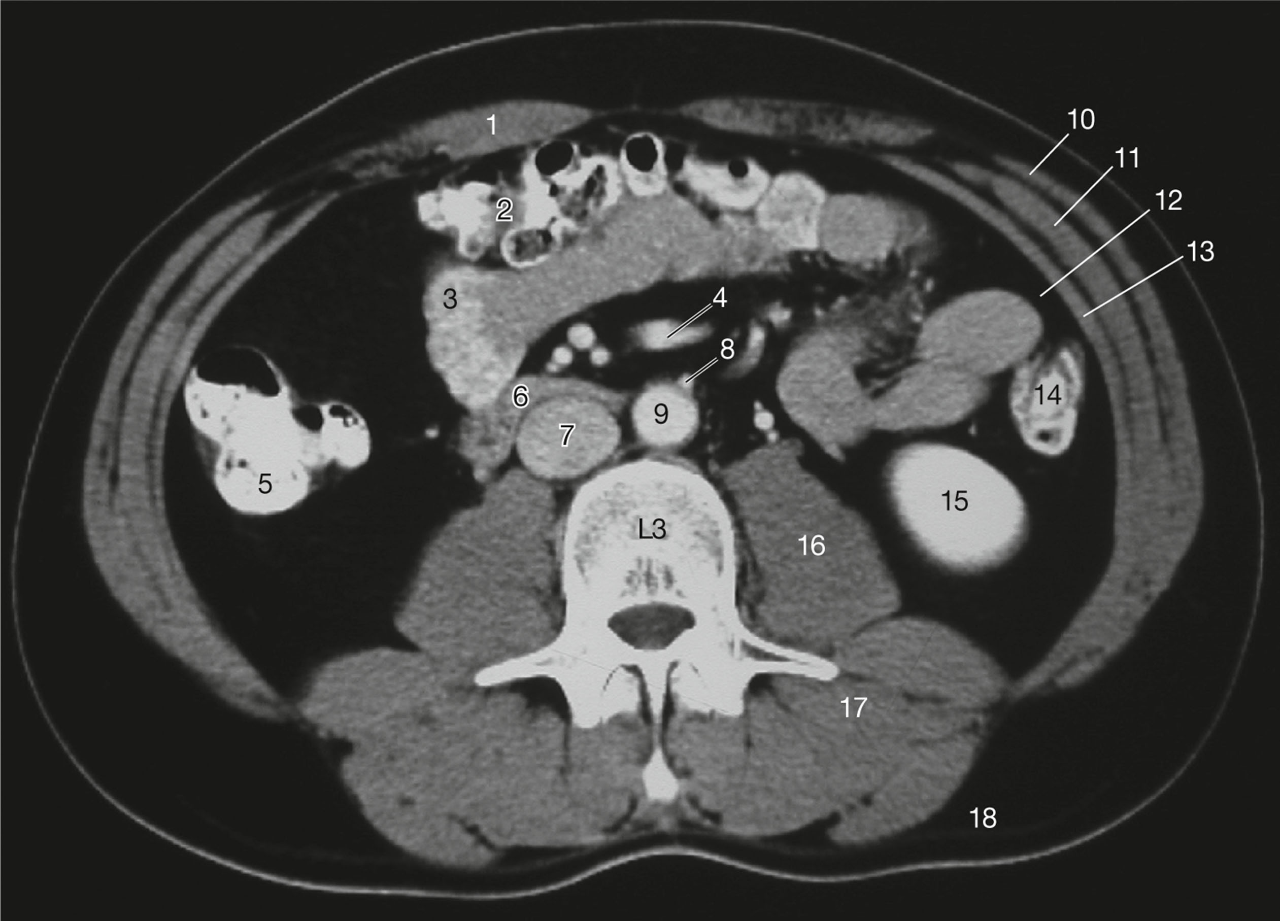 The Abdomen | Radiology Key