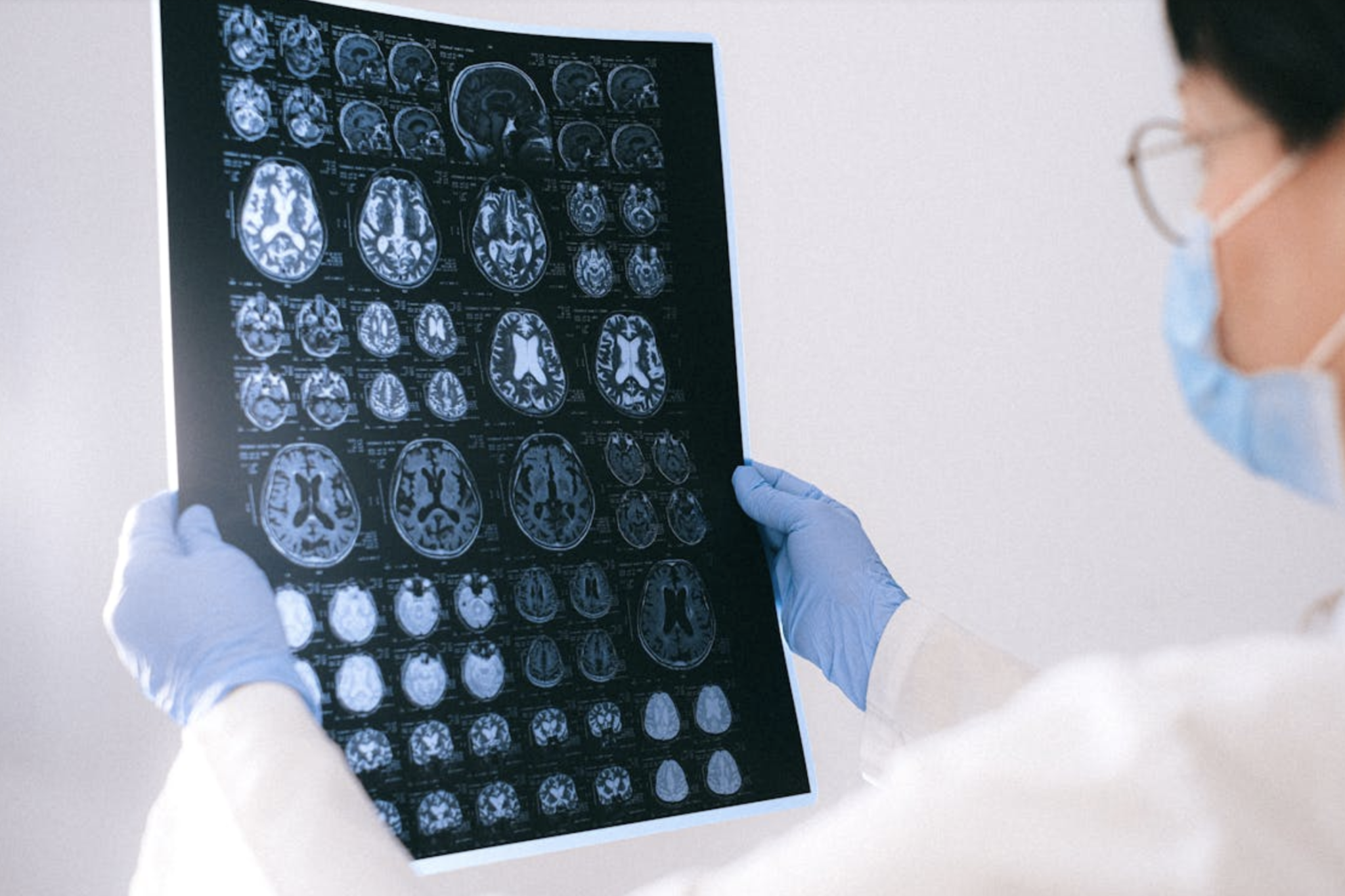 How CT Scans Support Early Interventions in High-Risk Scenarios ...
