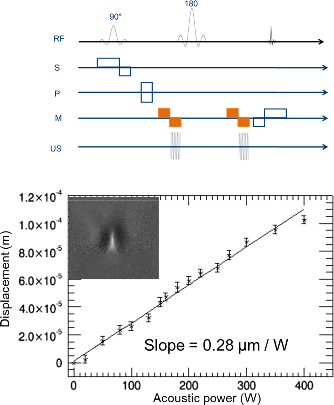 Interventional MRI | Radiology Key
