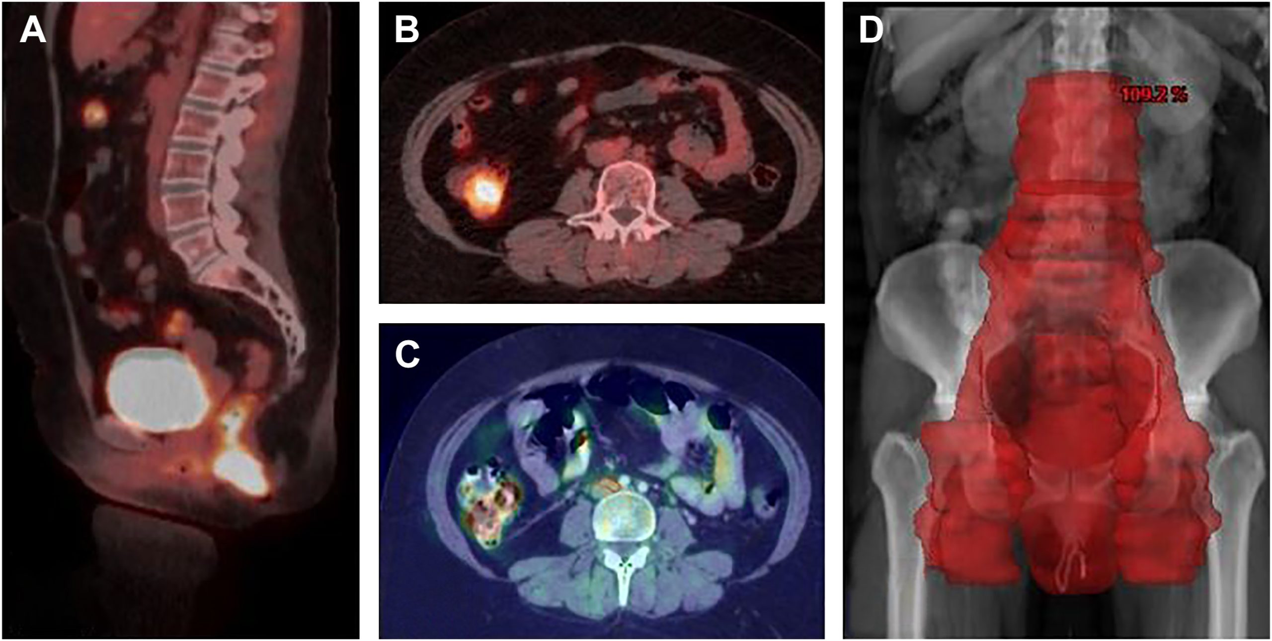 Updates in the Role of Positron Emission Tomography/Computed Tomography ...