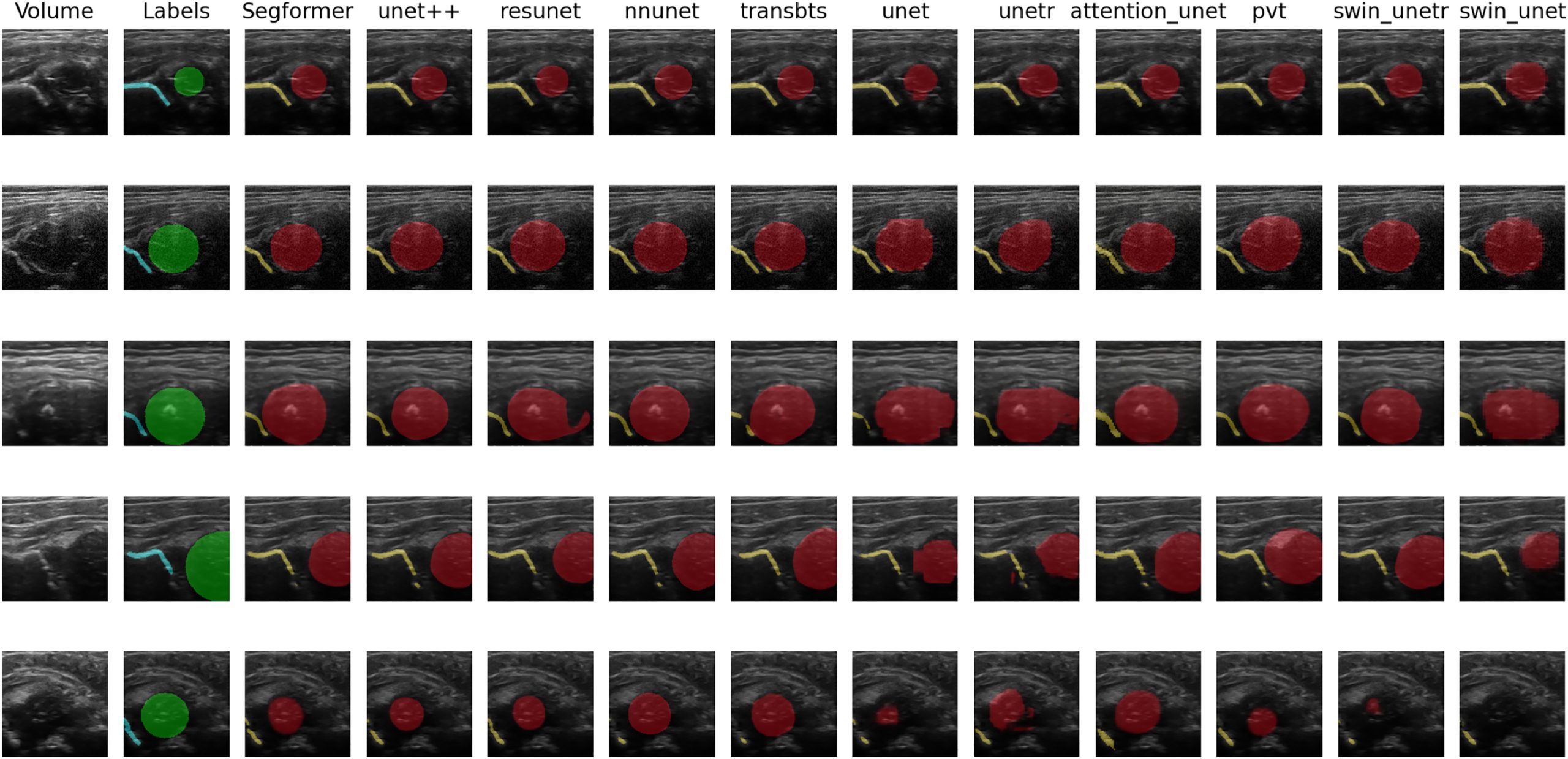 SegFormer3D: Improving the Robustness of Deep Learning Model-Based ...