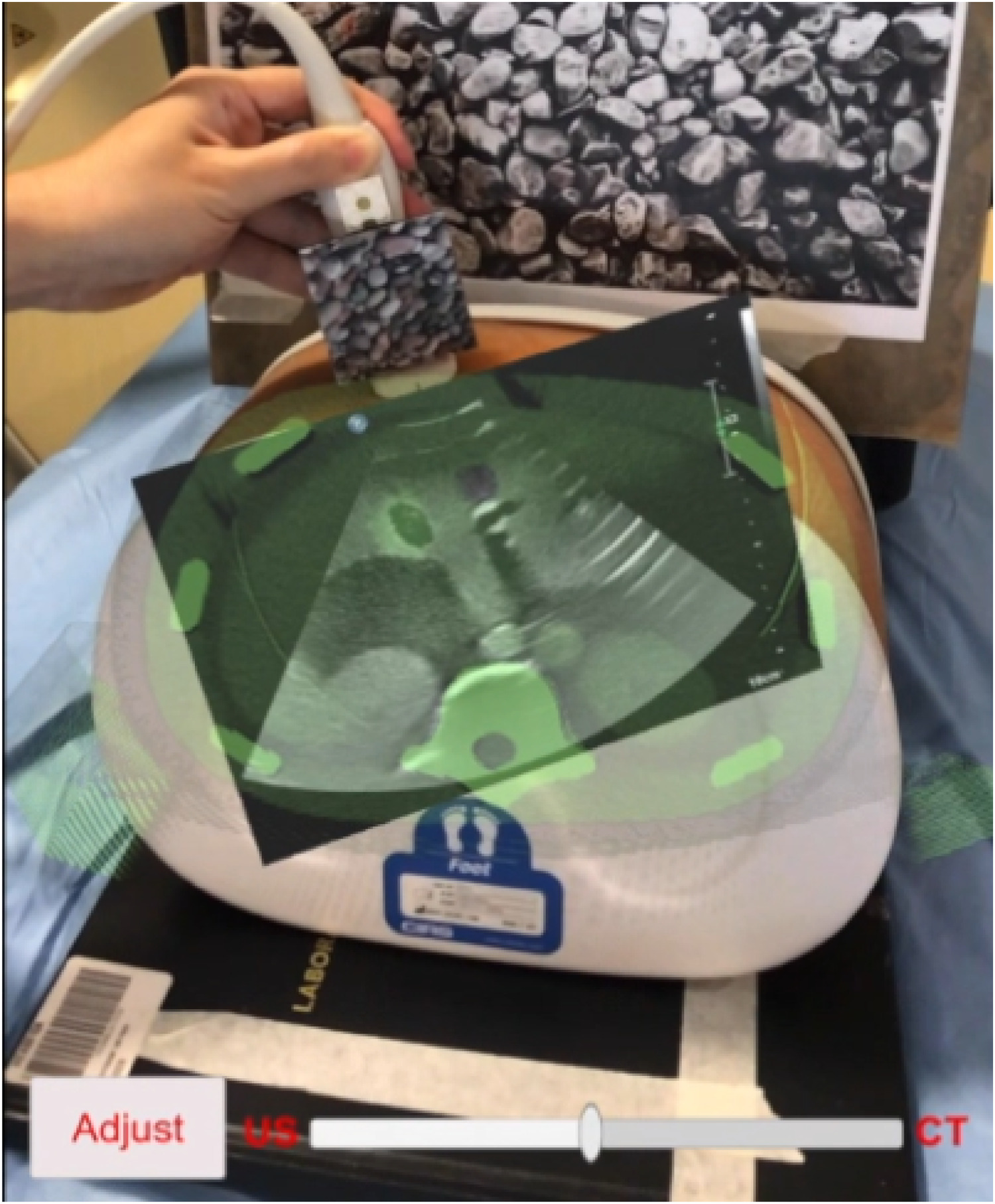 Fusion Technologies for Image-Guided Robotic Interventions | Radiology Key