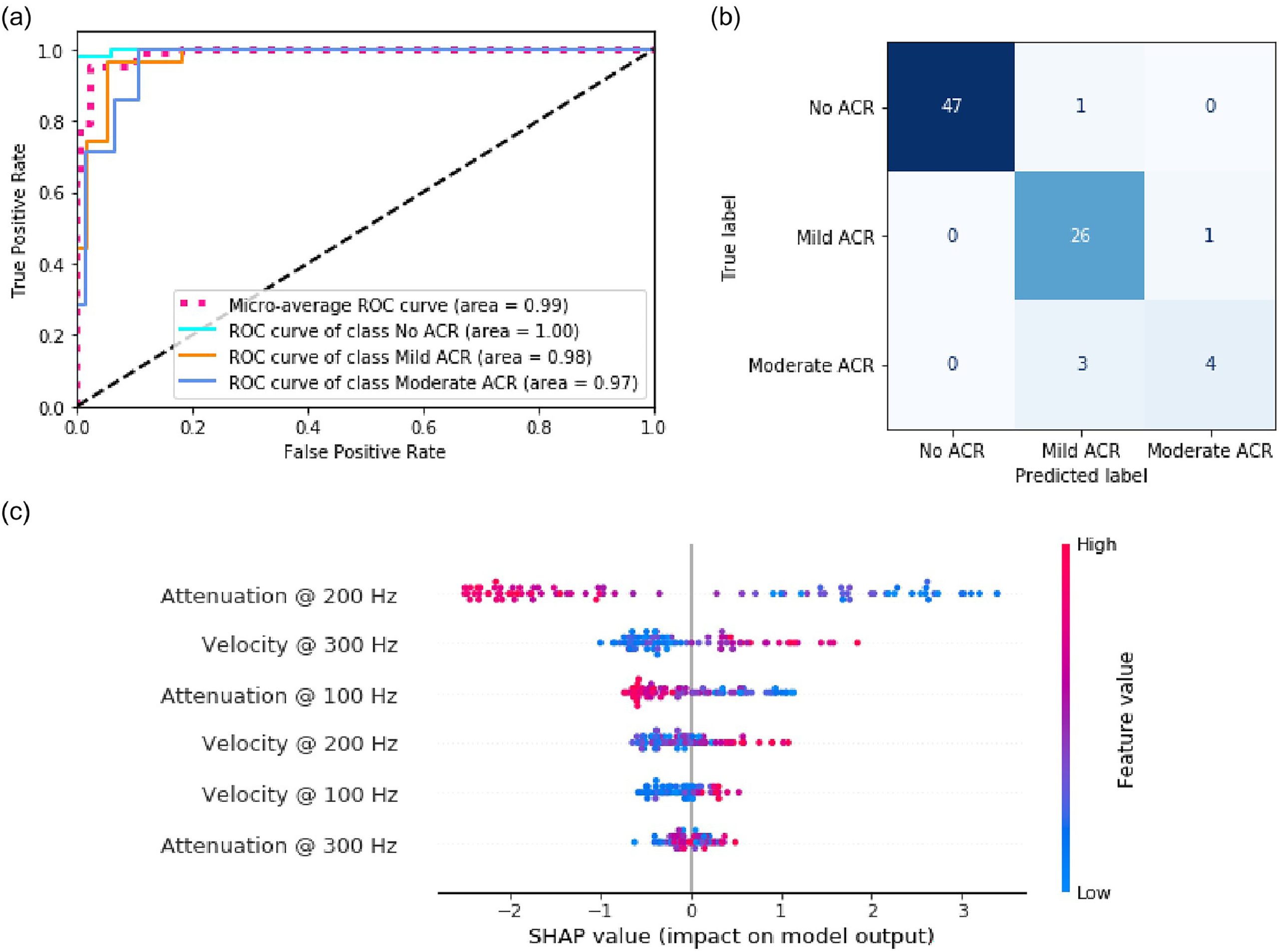 Attenuation Measuring Ultrasound Shearwave Elastography (AMUSE) as ...