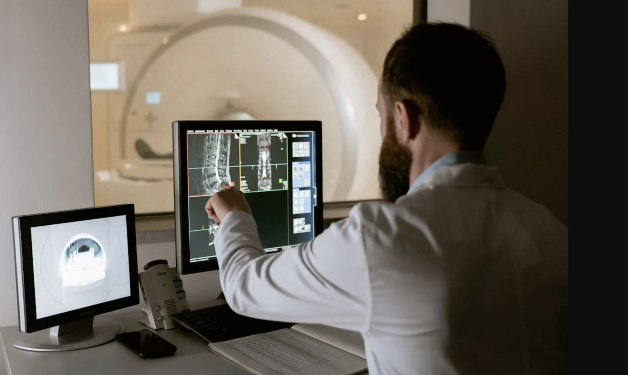 Evaluating the Impact of Long-Term Medication With Modern Imaging ...