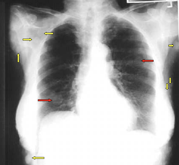 How to read X-raysRadiology Key