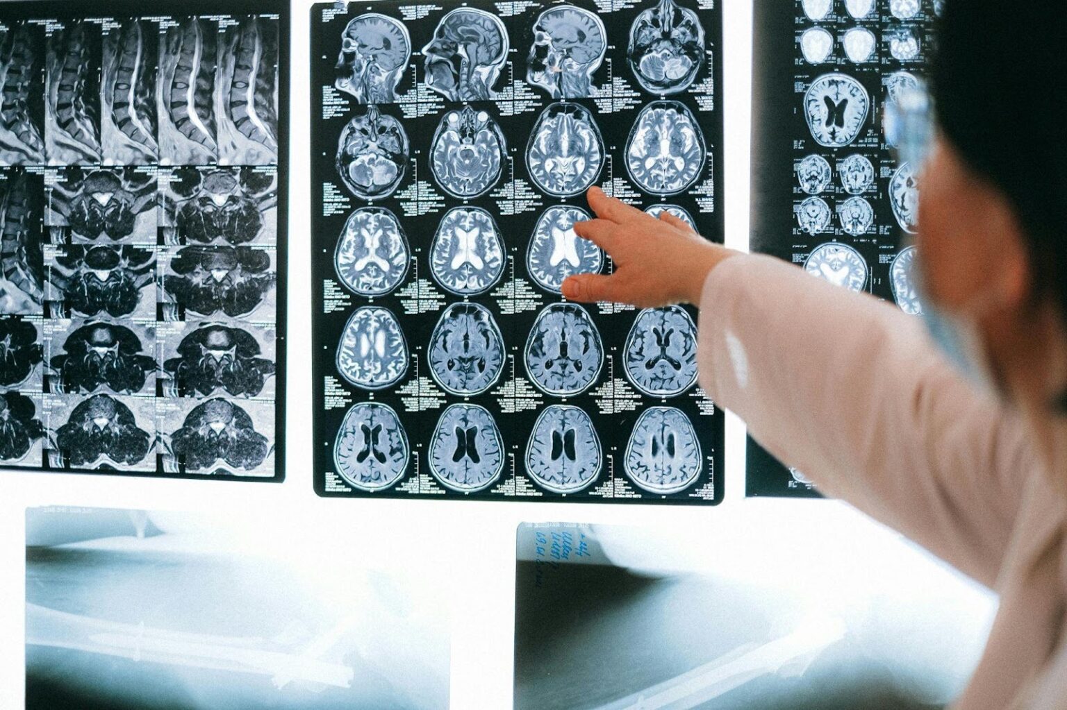 Radiology Research Topics: Student Projects That Work BestRadiology Key