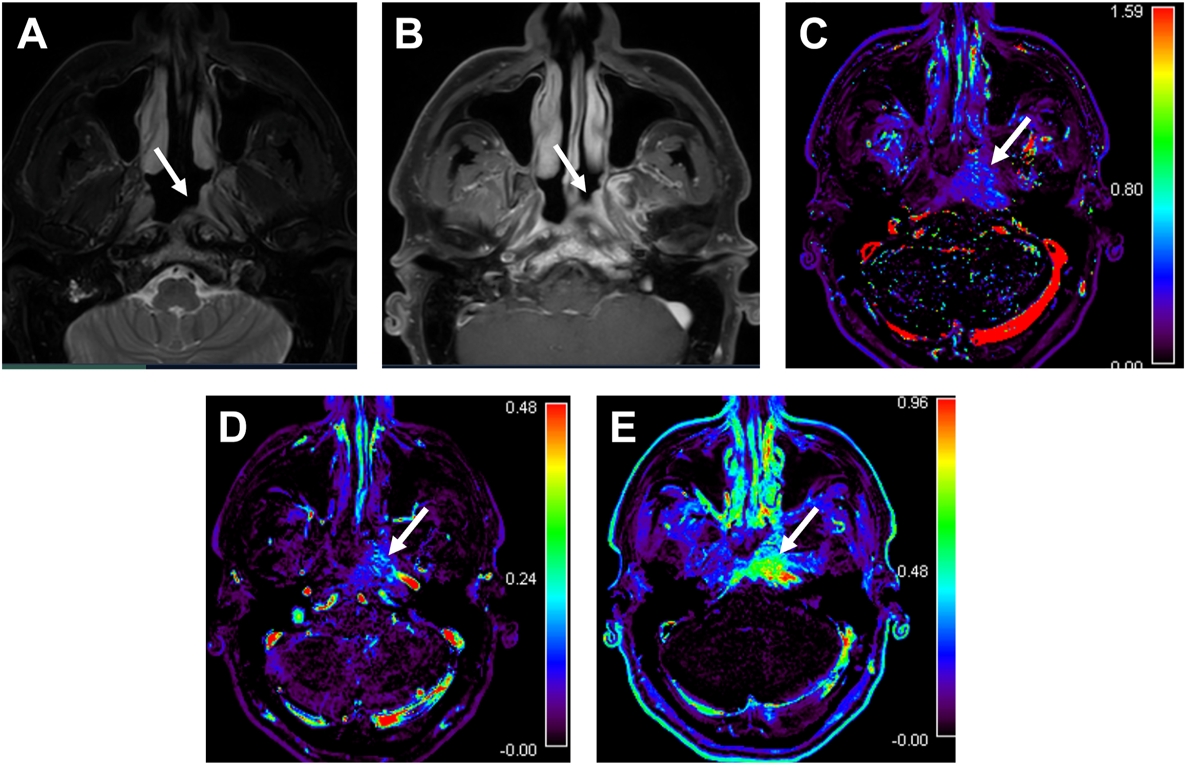 Advanced Imaging of the Head and Neck | Radiology Key